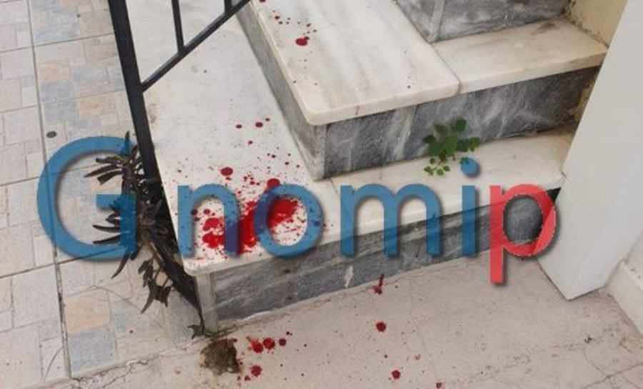 Πάτρα: Άγριος ξυλοδαρμός μαθητή έξω από ΕΠΑΛ – Του έσπασαν τη μύτη - elora.gr